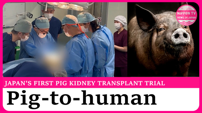 Japan to launch first clinical trial of pig kidney transplants | Nippon ...
