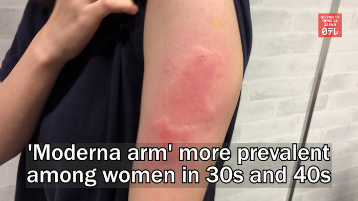 Moderna arm more prevalent among women in 30s and 40s | Nippon TV NEWS ...